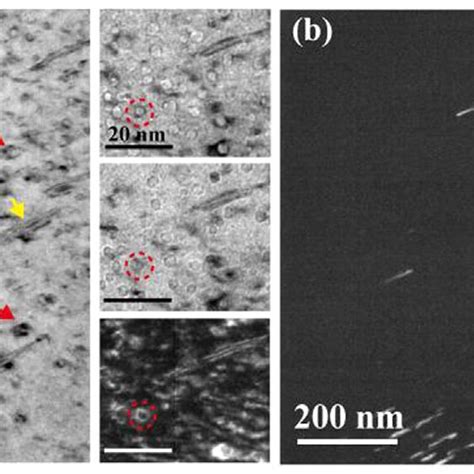 Representative A Bf Tem Image Showing Numerous Faulted Dislocation