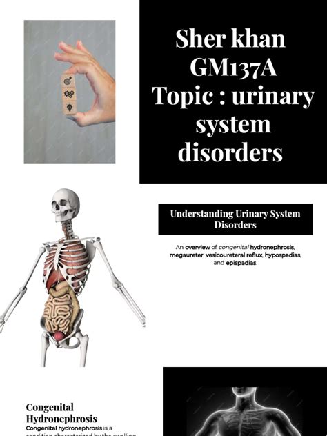 Urinary System Disorders Pdf Urinary System Medicine