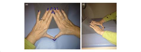Hand Positioning For Metacarpophalangeal MCP Stress View A Patient Download Scientific