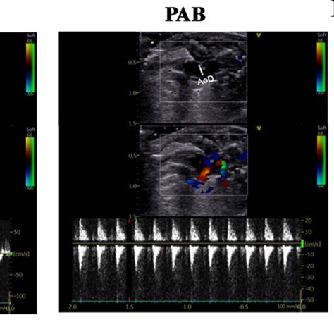 Validation Of Neonatal Pulmonary Hypoperfusion In Pab Rats At Postnatal Download Scientific