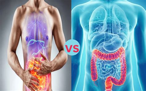 Ways Difference Between Colitis And Proctitis Can Help You Live Long Time A Blog With A