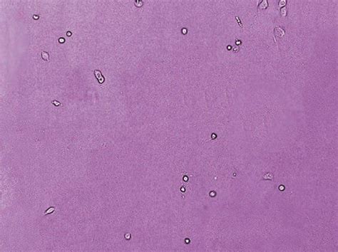 Comparison Of Cell Morphology Before And After Exposure To H2o2 Download Scientific Diagram