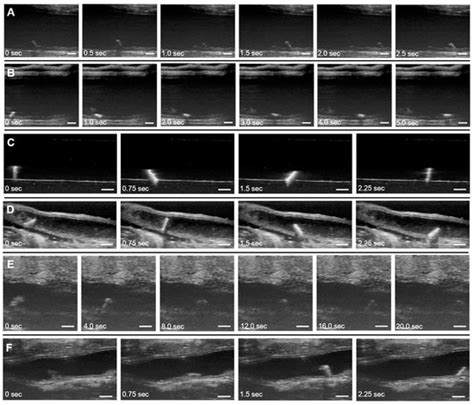 A Tumbling Magnetic Microrobot System For Biomedical Applications