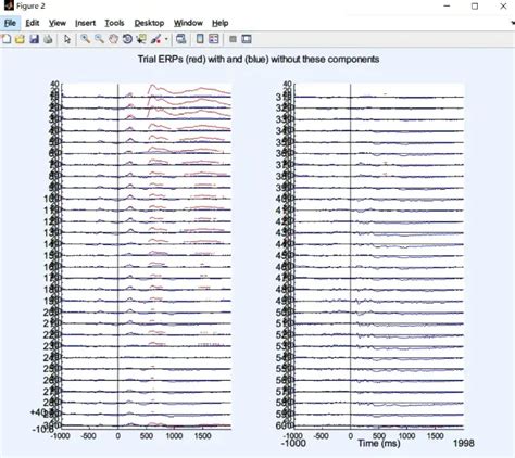Matlab脑电数据处理精要（三、实操） 知乎