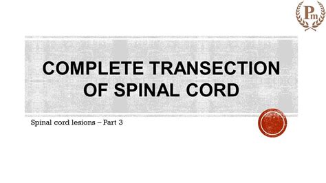 Features Of Complete Transection Of Spinal Cord Youtube