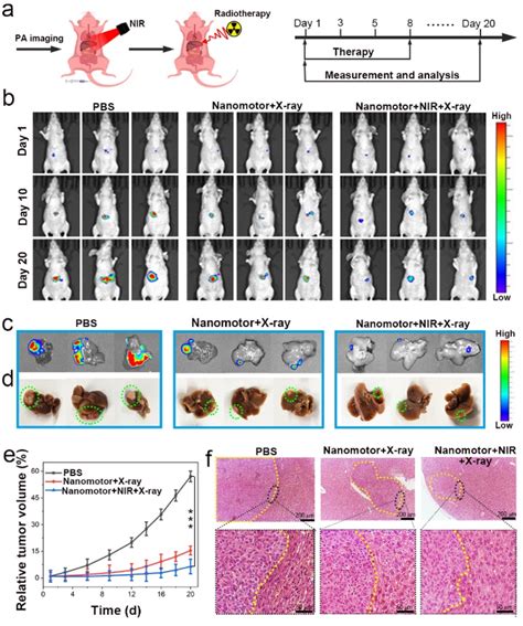 Orthotopic Liver Cancer Radiotherapy Effects Of The Aunr Tio2