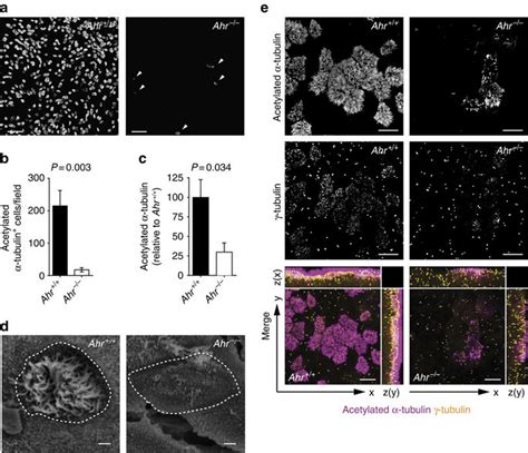 Multiciliated Cell Generation Is Markedly Reduced In Ahr Deficient Mtec Download Scientific