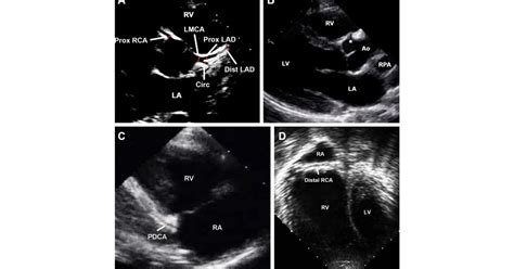 American Society Of Echocardiography Shares Updated Expert Recommendations On Pediatric