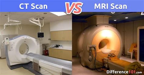 Ct Scan Vs Mri Whats The Difference Difference Sexiz Pix