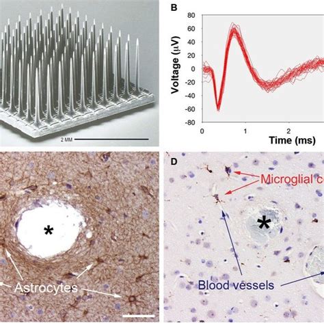 Pdf Acute Human Brain Responses To Intracortical Microelectrode Pdf Acute Human Brain Responses To Intracortical Microelectrode