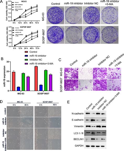 Mir 19 Inhibitor Suppresses Cell Proliferation Invasion Migration Download Scientific