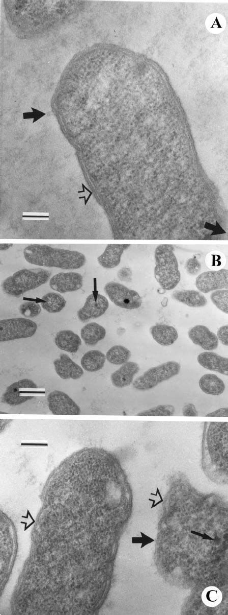 Effect Of Ph Conditions On The Ultrastructure Of E Carotovora Subsp Download Scientific