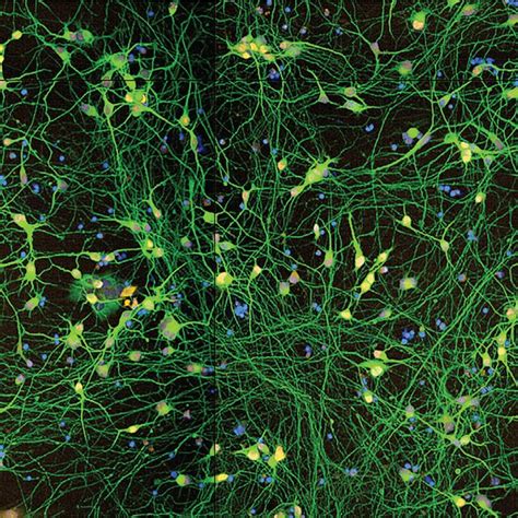 Mature Cortical Neurons Immunostained With Tbr1 To Identify Mature