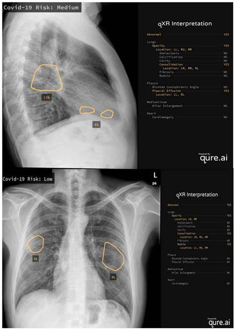 Diagnostics Free Full Text Chest X Ray In Emergency Radiology What Artificial Intelligence