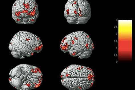 Brain Fmri Scan