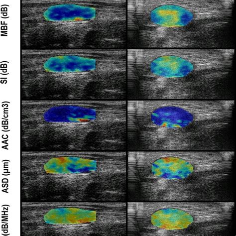 Representative Ultrasound B‐mode Images Upper Row With Six Spectral