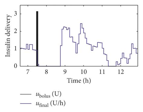 Operation Of The Dynamic Rule Based Algorithm During A Postprandial
