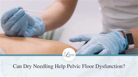 Can Dry Needling Help My Pelvic Floor Legacy Physical Therapy
