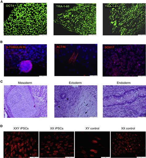 Modeling Sex Differences In Humans Using Isogenic Induced Pluripotent Stem Cells Stem Cell Reports Modeling Sex Differences In Humans Using Isogenic Induced Pluripotent Stem Cells Stem Cell Reports