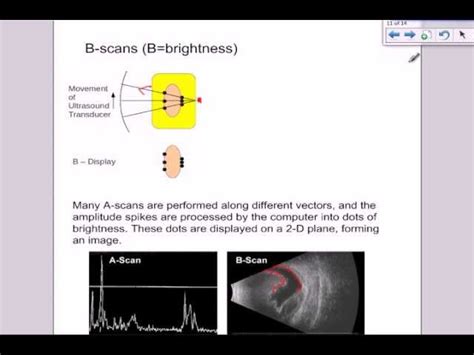 Different Types Of Scans