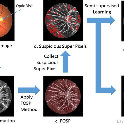 The Pipeline Of Our Proposed Semi Supervised Learning Method On The