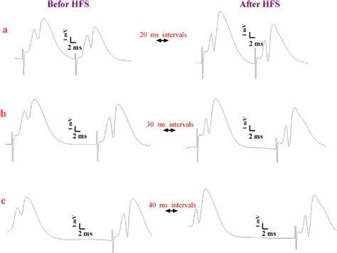 Representative Sample Traces Of Field Potentials Evoked By Paired Pulse Download Scientific