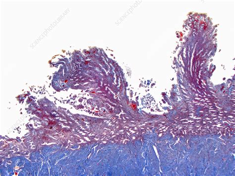 Human Uterus Light Micrograph Stock Image C055 6332 Science Photo Library