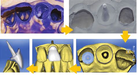 Workflow Of The Scanning Procedure To Generate A 3 D Digital Model Download Scientific Diagram
