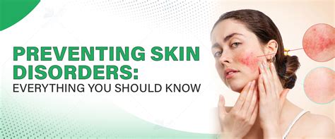Preventing Skin Disorders Everything You Should Know Felix Hospital