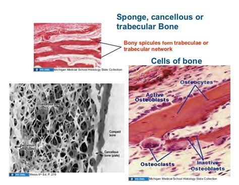 Spicules Bone