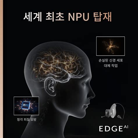 스타키코리아 보청기 업계 최초 신경망 처리 장치npu를 탑재한 인공지능 보청기 Edge Ai🦻를 소개합니다~ Edge Ai의 인공지능 기술은 인간의 두뇌를