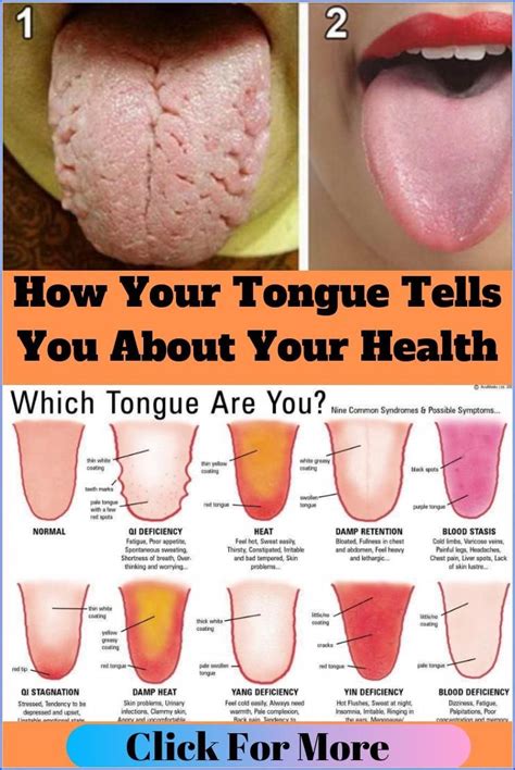 What The Tongue Tells About Health Artofit