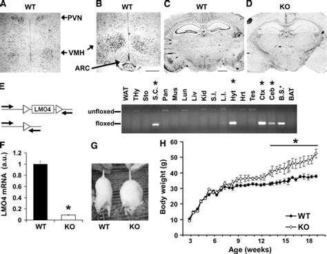 Neuron Specific Ablation Of Lmo4 Leads To Adult Onset Obesity In Download Scientific Diagram
