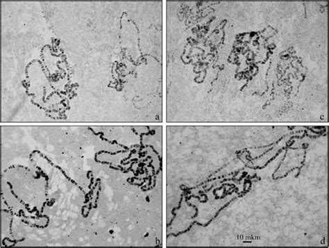 Polytene Chromosomes Of Drosophila Melanogaster After Oral