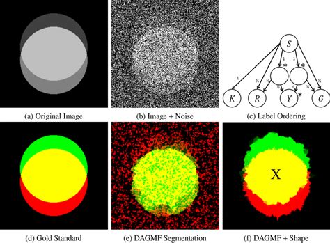 Venn Diagram Segmentation With And Without Shape Complexes The Label