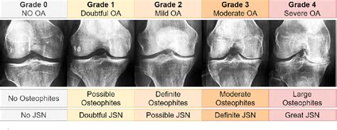 figure 1 from exploring the efficacy of base data augmentation methods in deep learning based