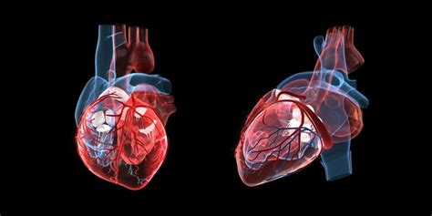 【临床】心脏瓣膜病历年必考点 哔哩哔哩