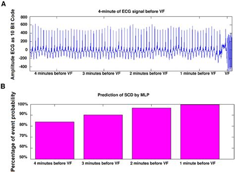 Prediction Of Scd By Classification Accuracy 4 Minutes Before Download Scientific Diagram