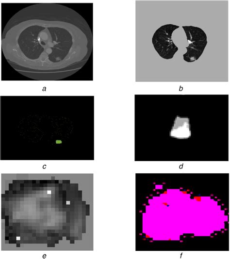 Sample Results Of The Experiment A Input Image 1 B Lung Lobe Download Scientific Diagram