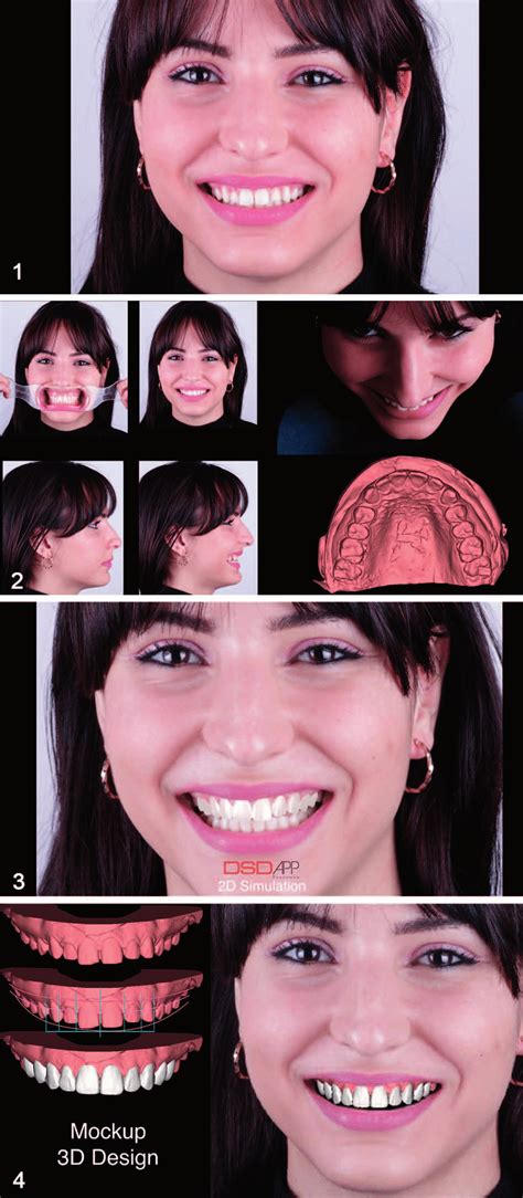 DSD Photographic Protocol Of The Patient And Occlusal Scan Of Upper Model Download Scientific