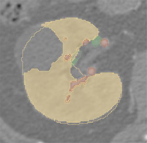 Figure 1 From Ensembled Autoencoder Regularization For Multi Structure