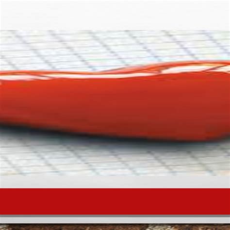 Heart Disease Prediction Uci Kaggle