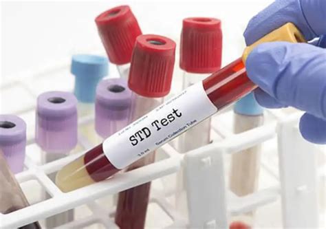 Re Infection Risks Why You Need Repeat Std Testing