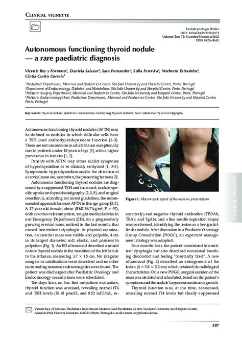 Pdf Autonomous Functioning Thyroid Nodule — A Rare Paediatric Diagnosis Daniela Salazar