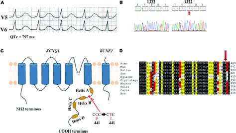 Characterization Of Long Qt Syndrome Type 1 In A Patient With The P441l Download Scientific