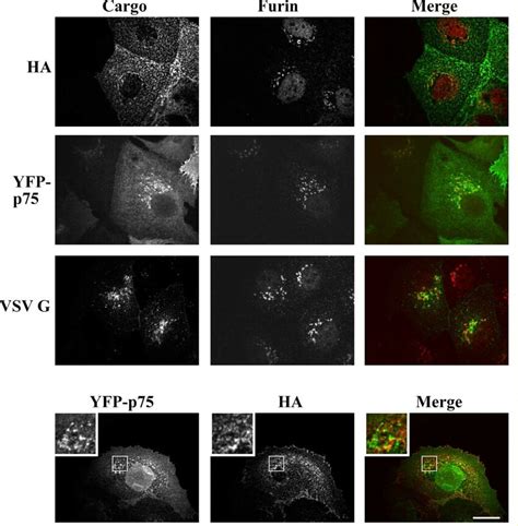 1 YFP P75 And HA Do Not Co Localize Intracellularly After Low