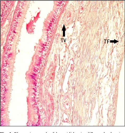 Labeled Epididymis Microscope Slide