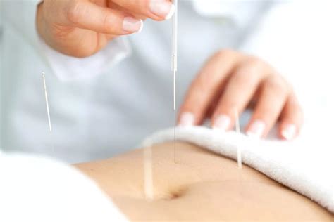 Acupuncture And Fertility New Hope Fertility Center