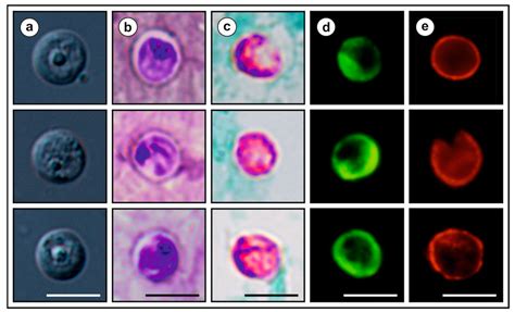 Cryptosporidium Parvum Microscope