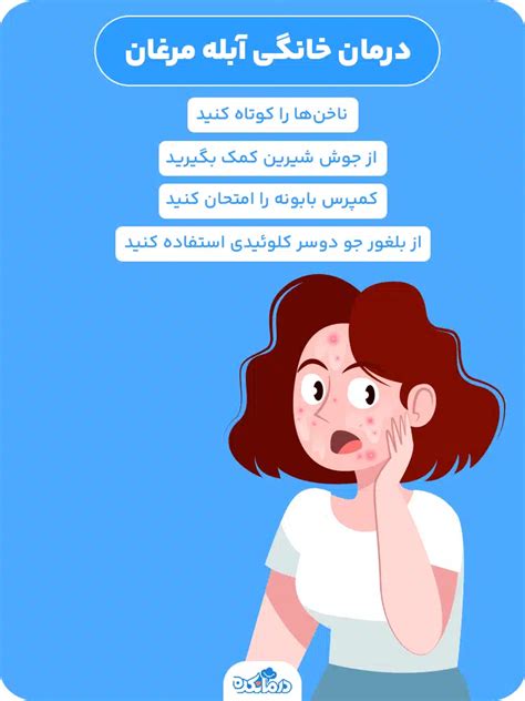 درمان آبله مرغان چیست؟ بهترین درمان در کودکان و بزرگسالان